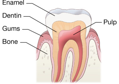 What Damages a Tooth's Pulp and Nerves? - Best Root Canal Specialist NYC